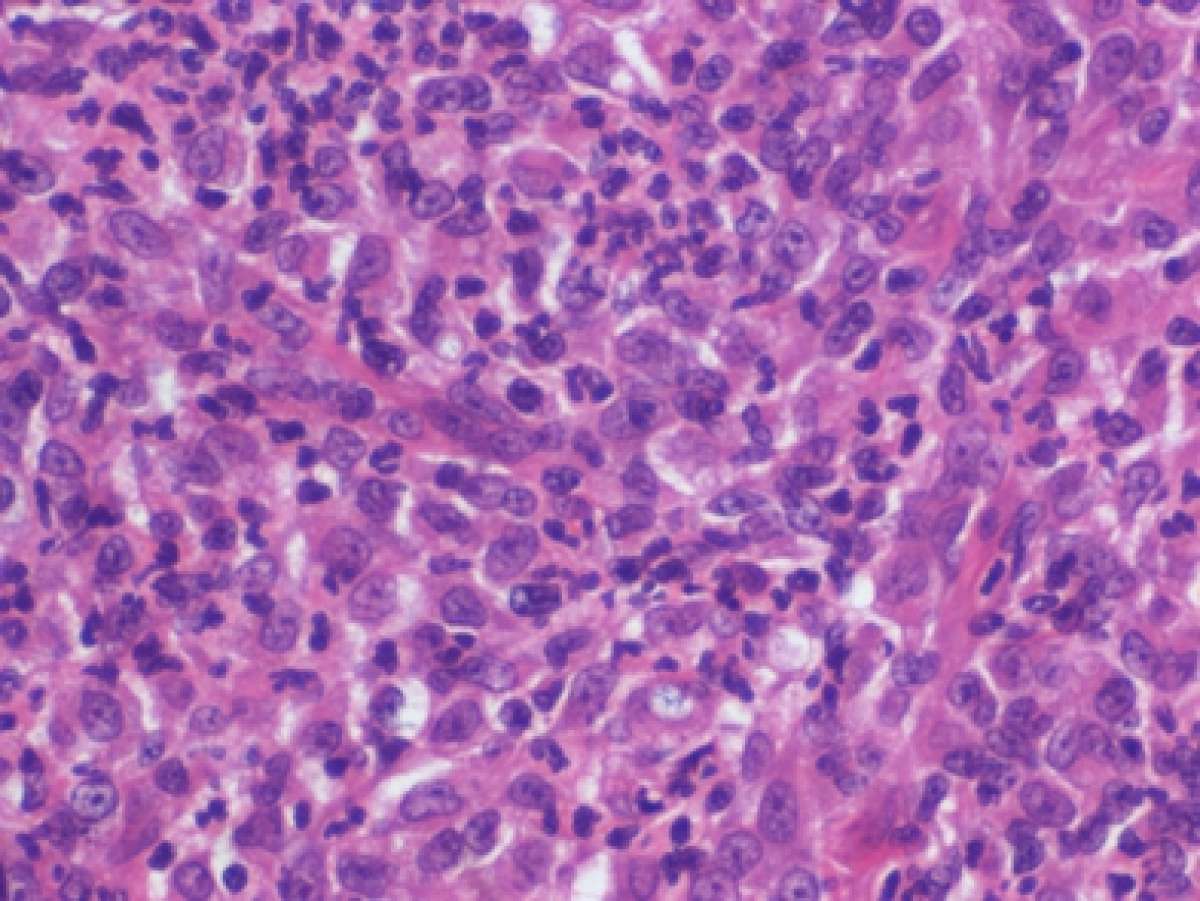 FIP in a cat - an uncommon presentation | Case Study | Cytopath