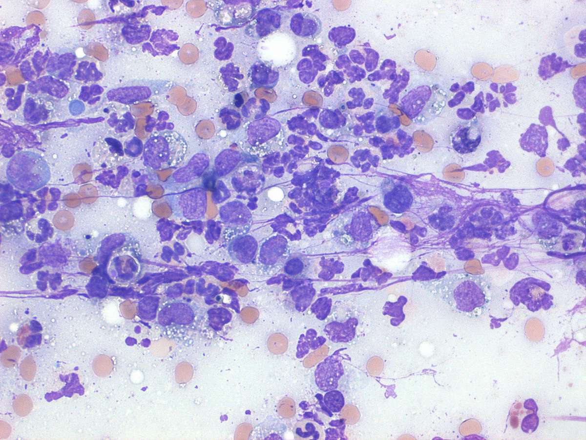 Kerion dermatophytosis in a Cocker spaniel | Case Study | Cytopath