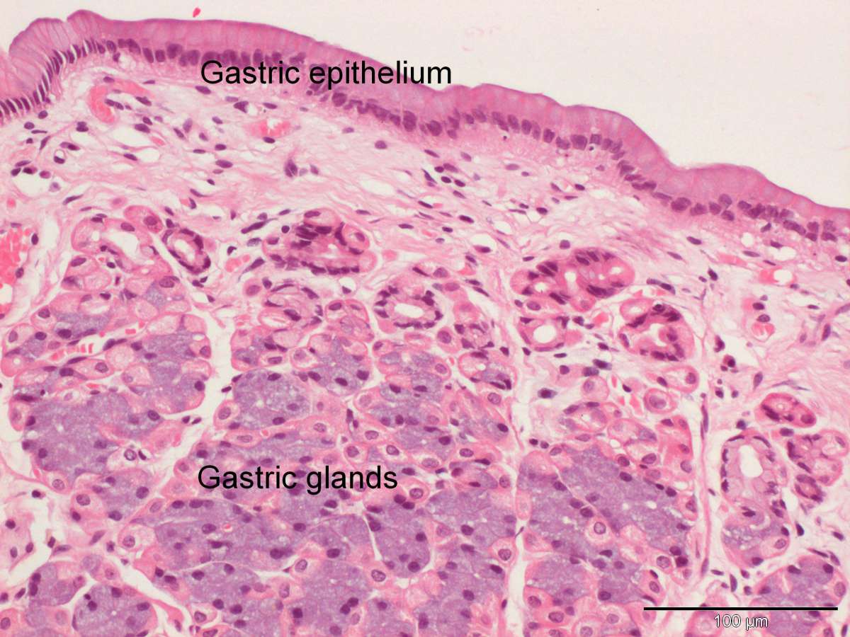 Signet-ring cell carcinoma in the stomach of a dog | Case Study | Cytopath