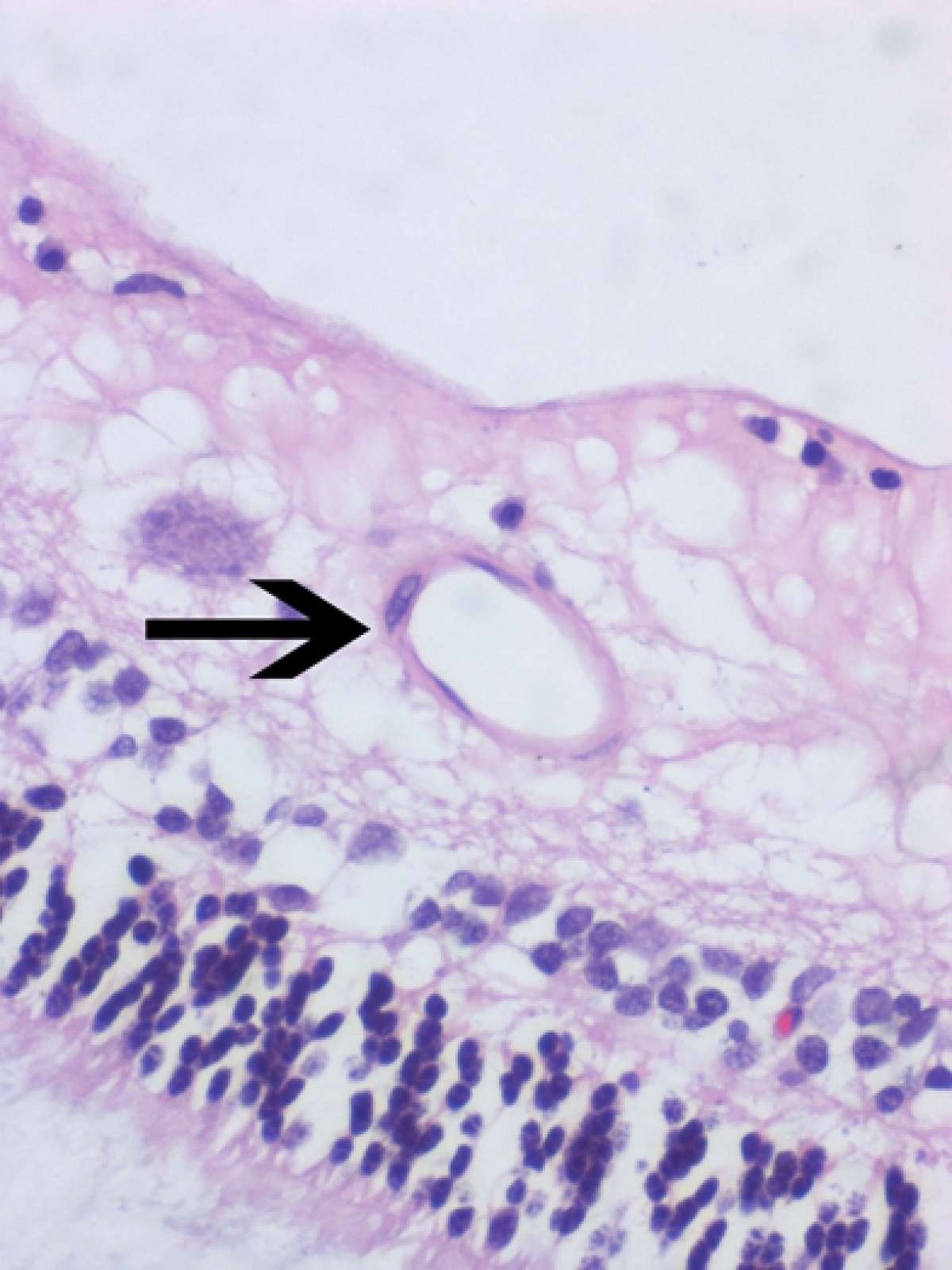 Hypertensive retinopathy in a dog | Case Study | Cytopath