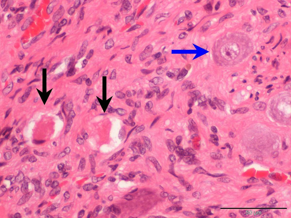 Key-Gaskell syndrome in a cat | Case Study | Cytopath