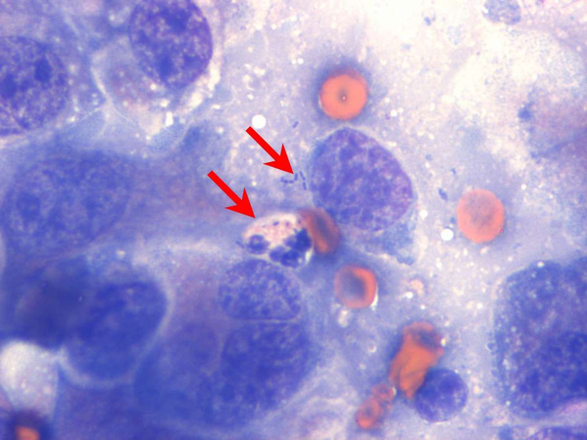 Transitional cell carcinoma (TCC) in a dog | Case Study | Cytopath
