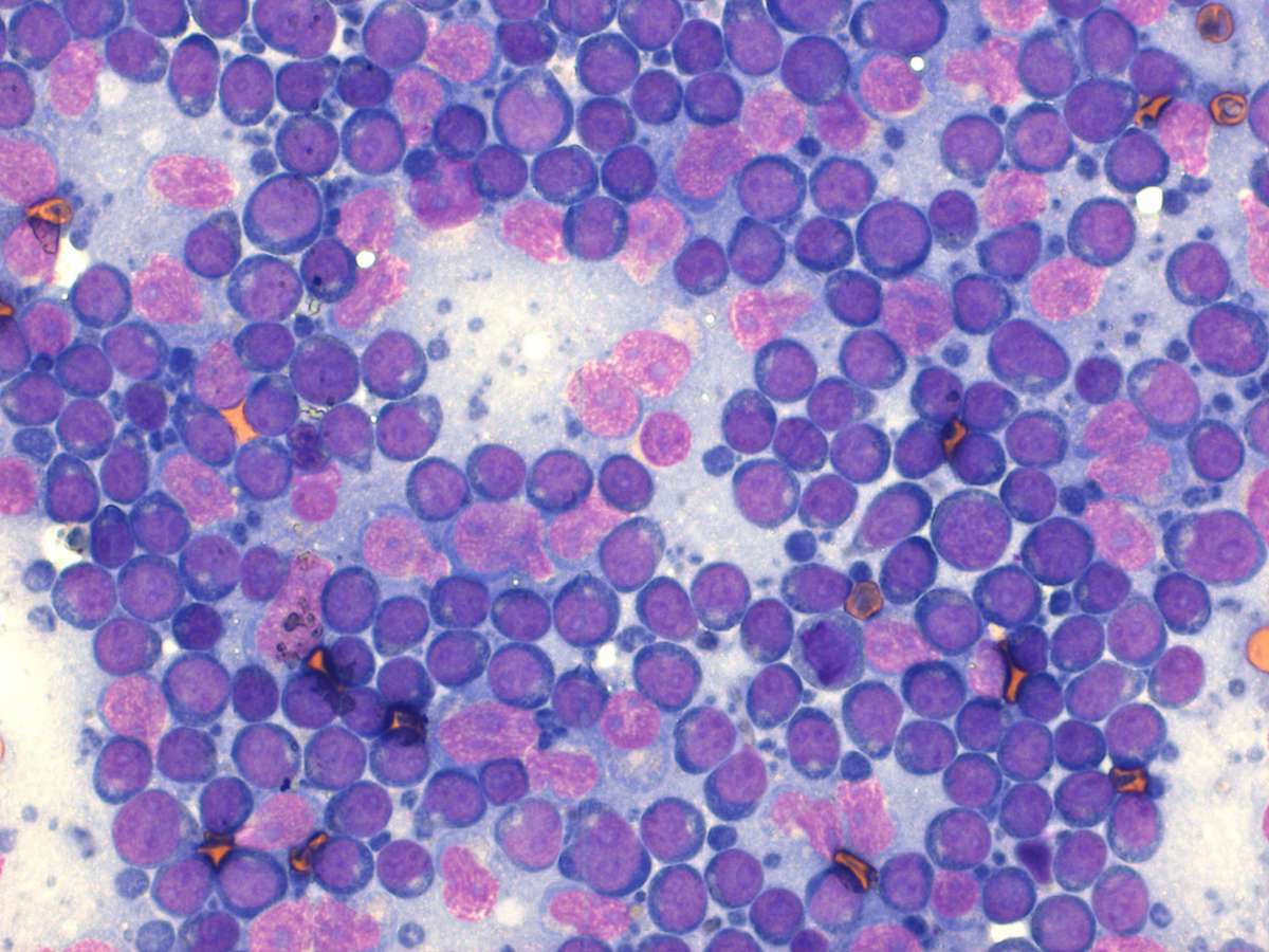 Cytology sample advice | Cytopath