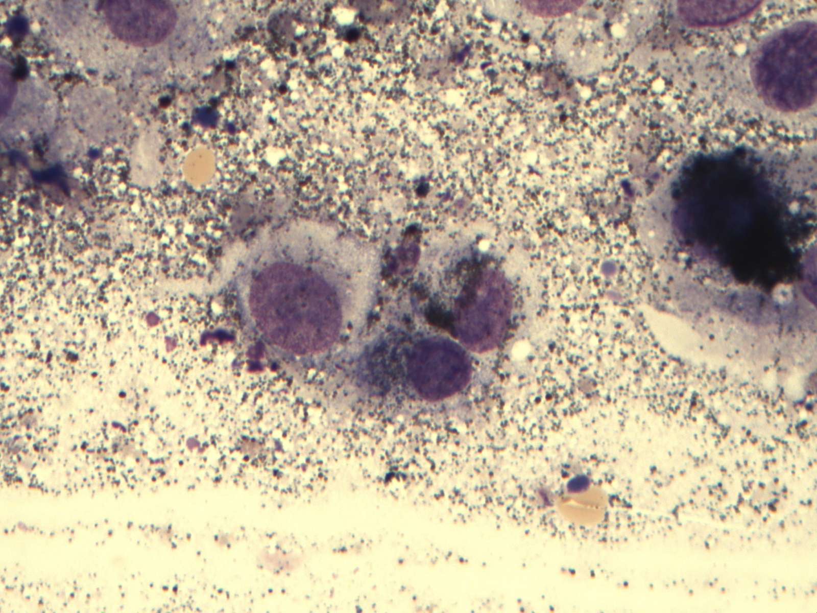 Cutaneous malignant melanoma in a rabbit | Case Study | Cytopath