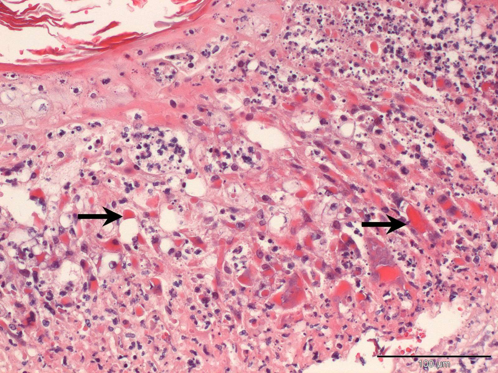 Cutaneous cowpox virus infection in a cat | Case Study | Cytopath