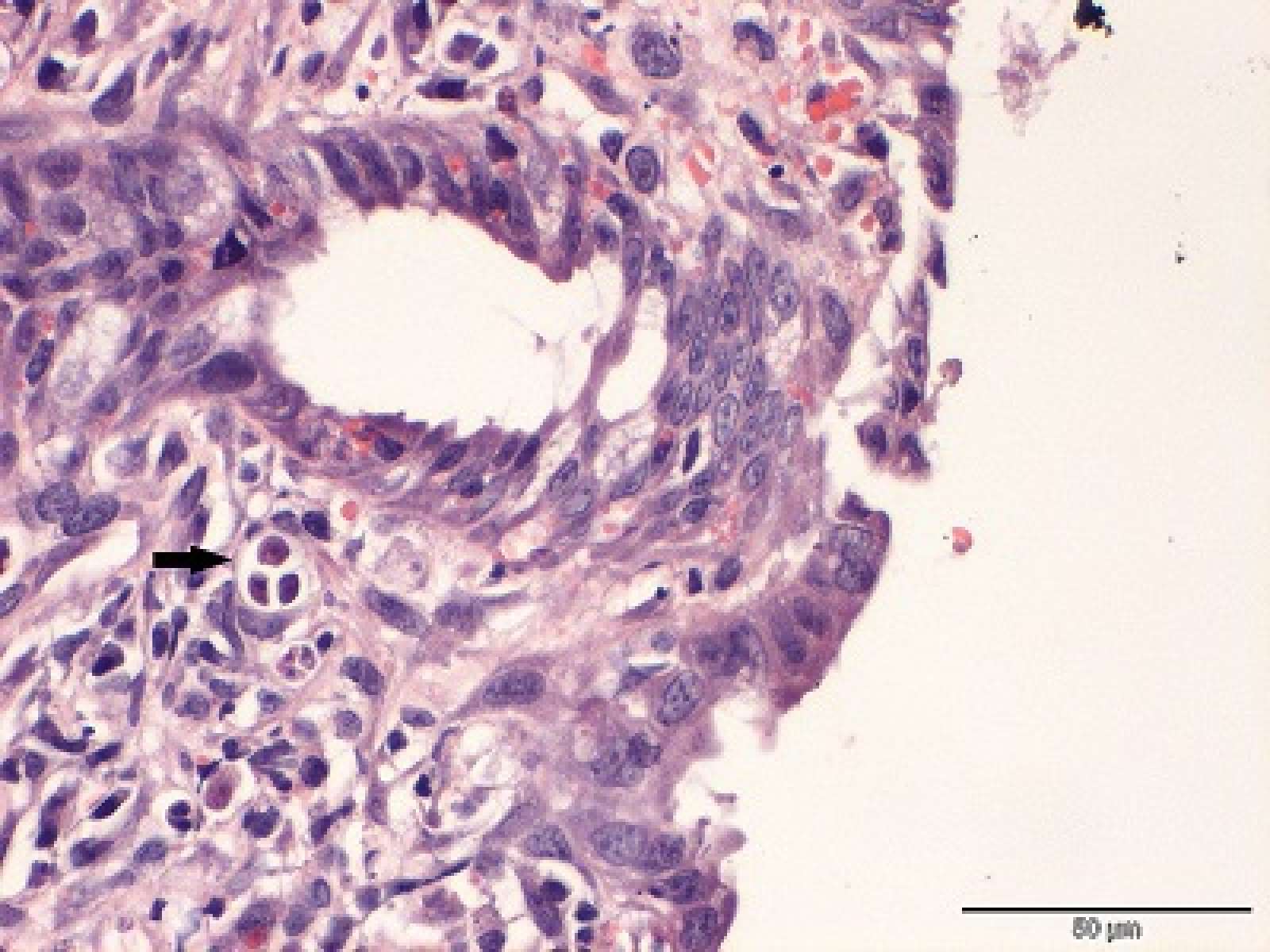 Prototheca infection in a dog | Case Study | Cytopath