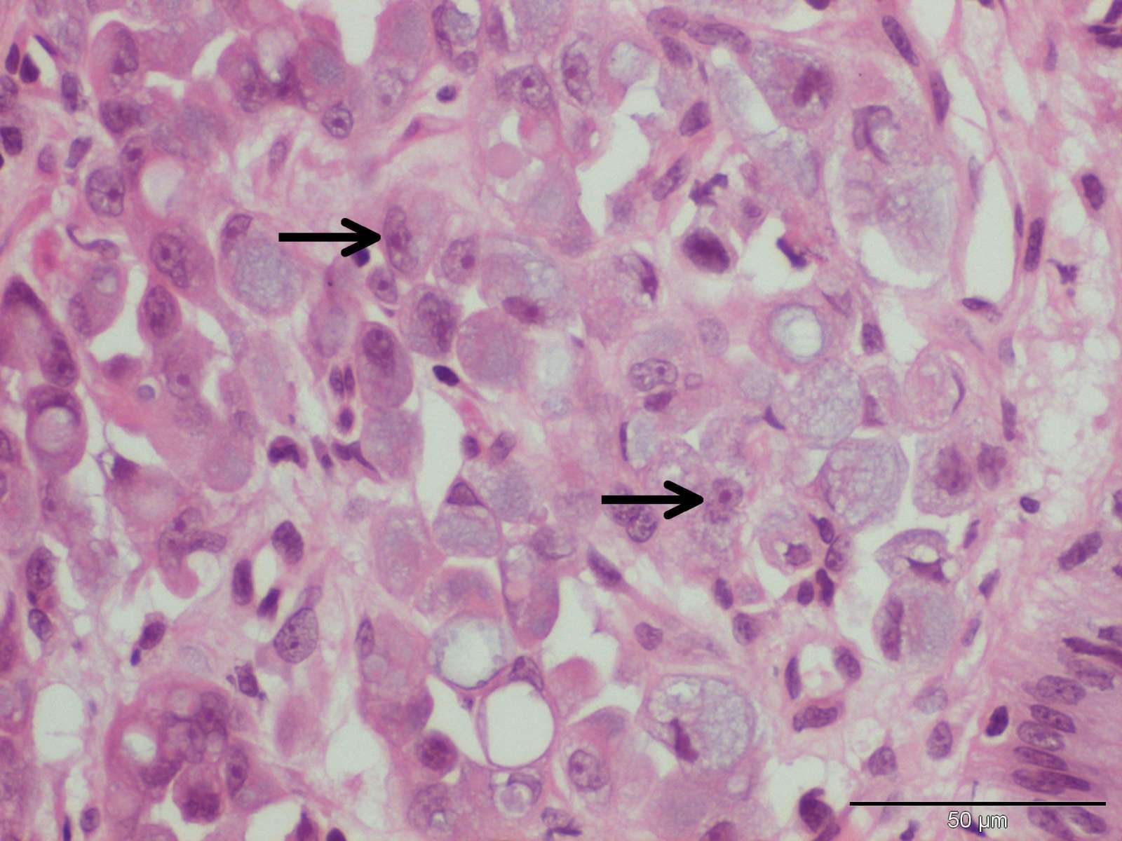 Signet-ring cell carcinoma in the stomach of a dog | Case Study | Cytopath
