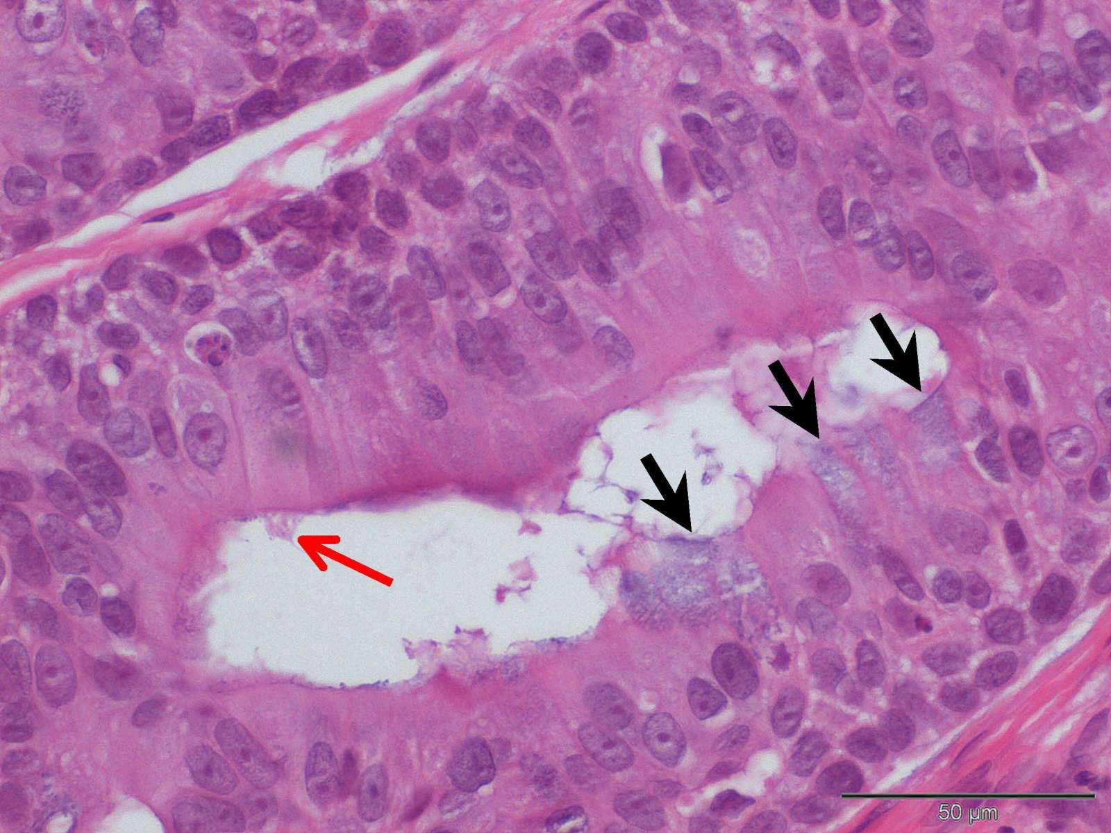 ‘Lung-digit’ syndrome in a cat | Case Study | Cytopath
