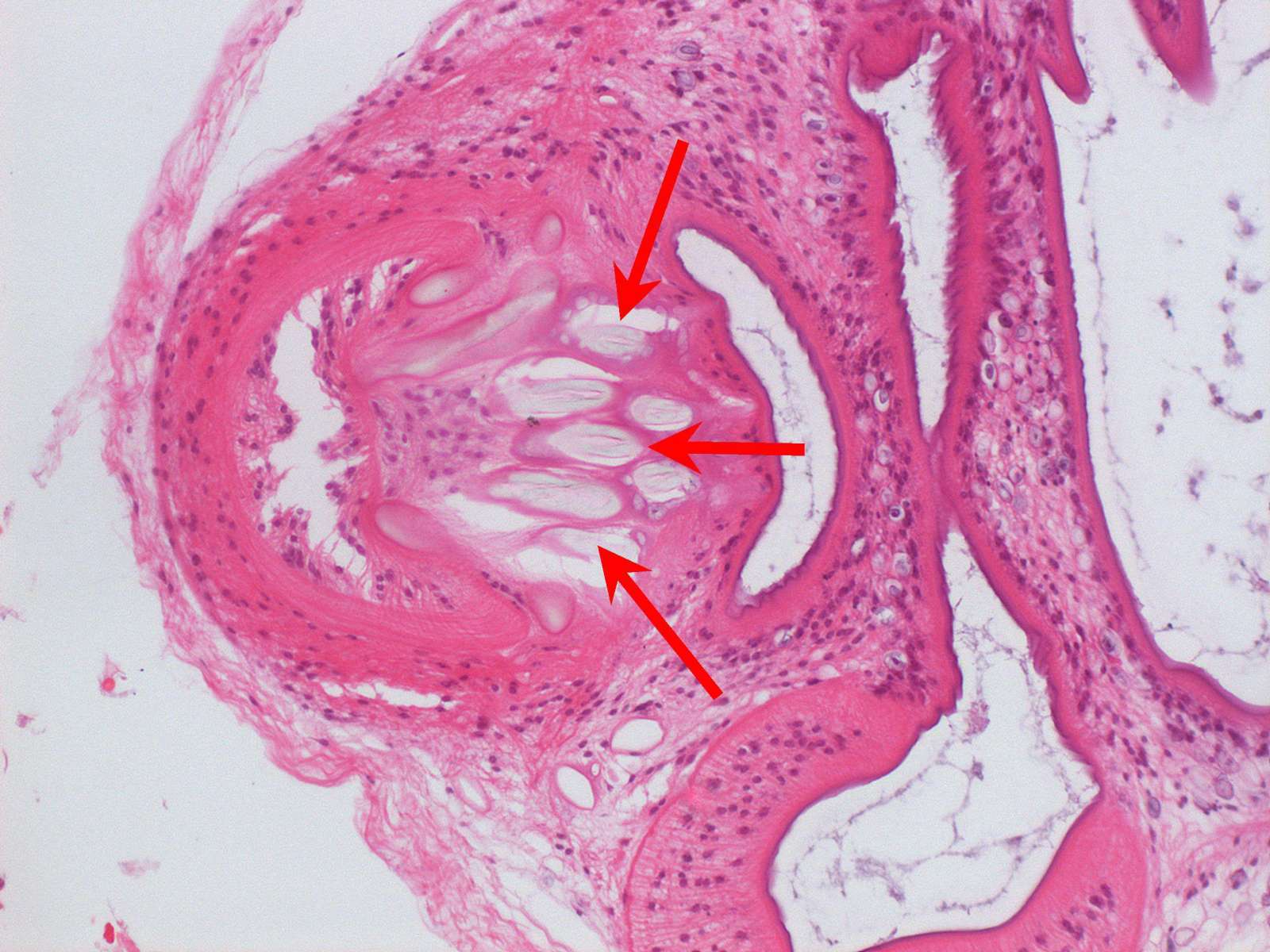 Subcuticular coenurus in a rabbit | Case Study | Cytopath