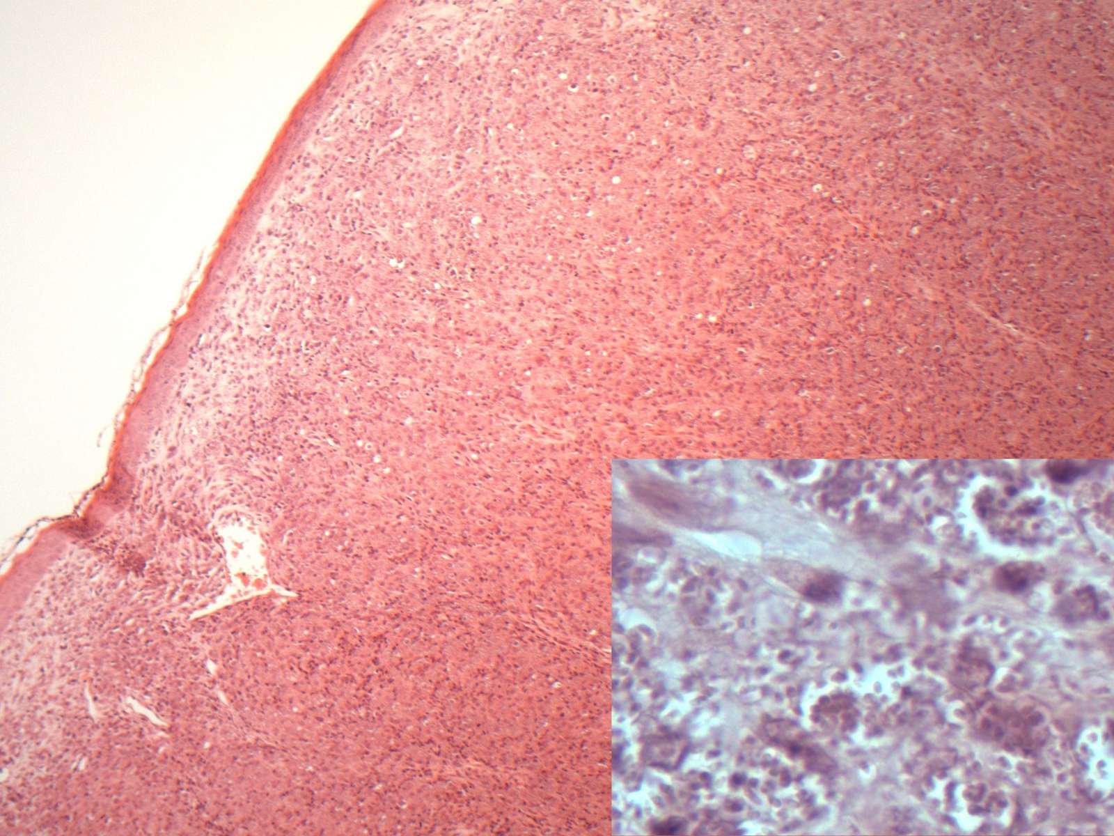 Protozoal dermatitis in a dog | Case Study | Cytopath