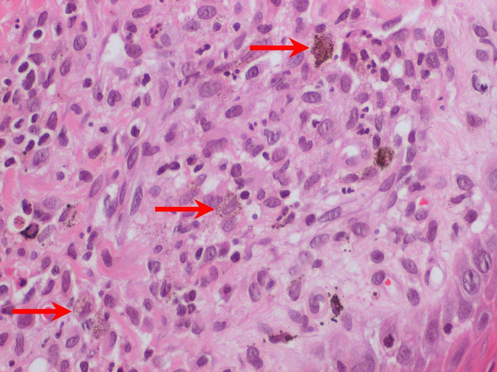 Uveodermatological syndrome in an Akita | Case Study | Cytopath