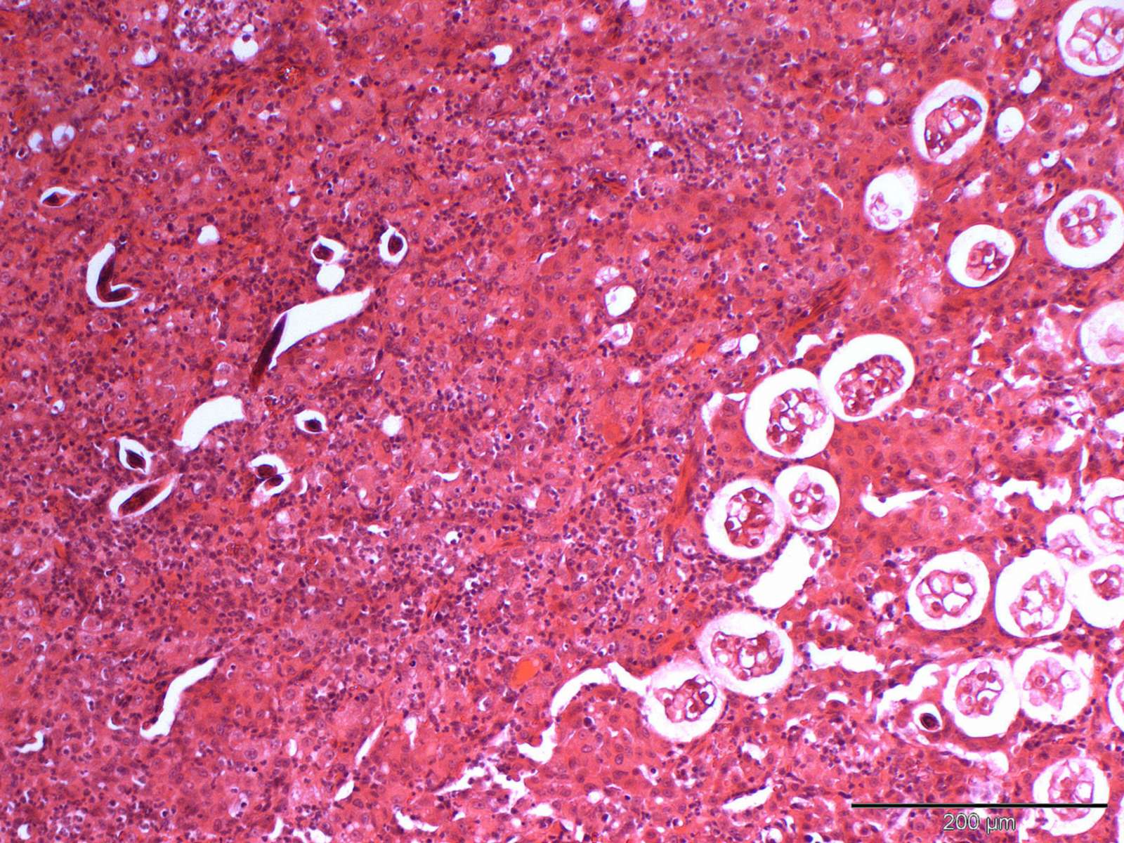 Feline Lungworm | Case Study | Cytopath