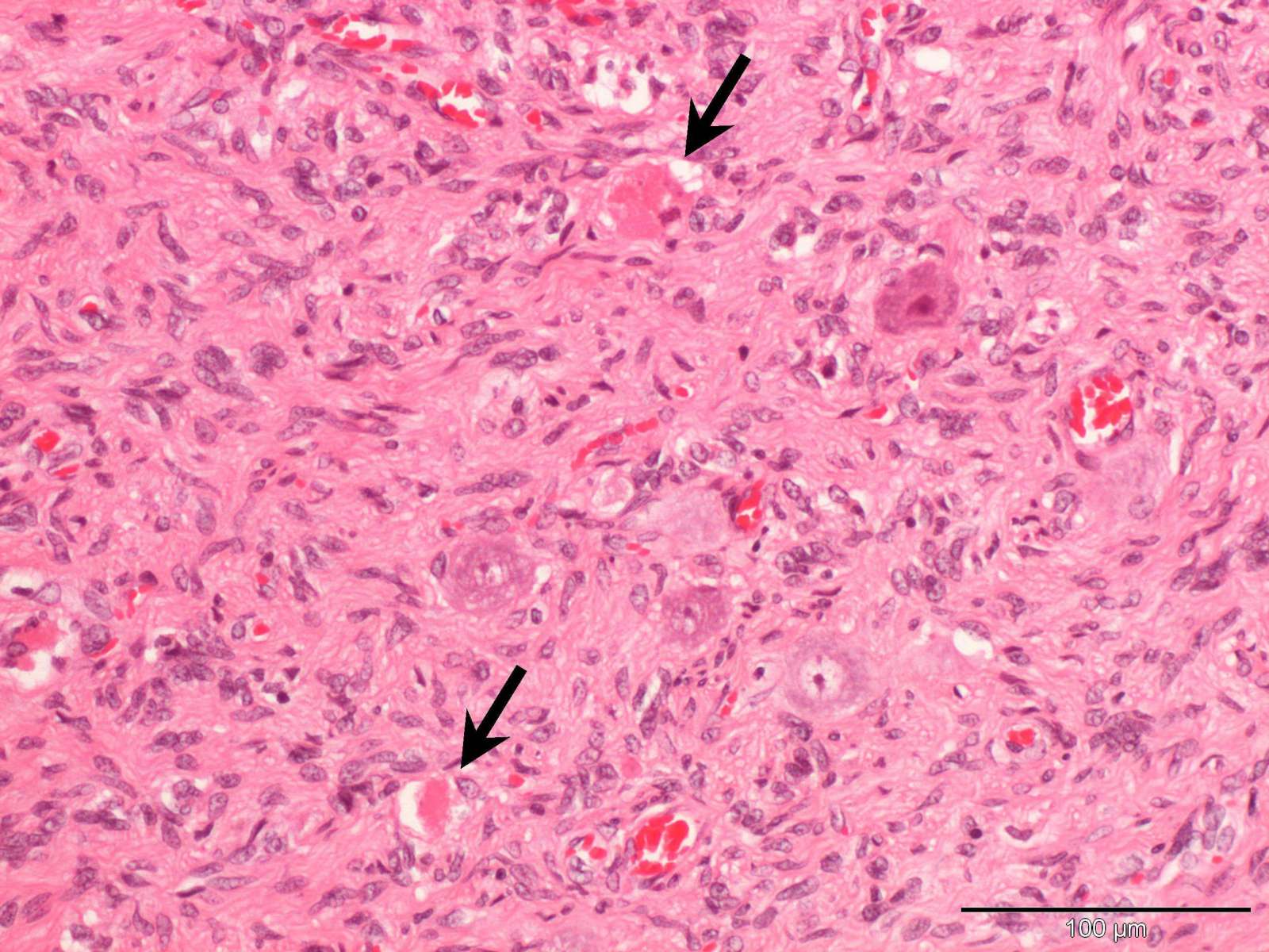 Key-Gaskell syndrome in a cat | Case Study | Cytopath