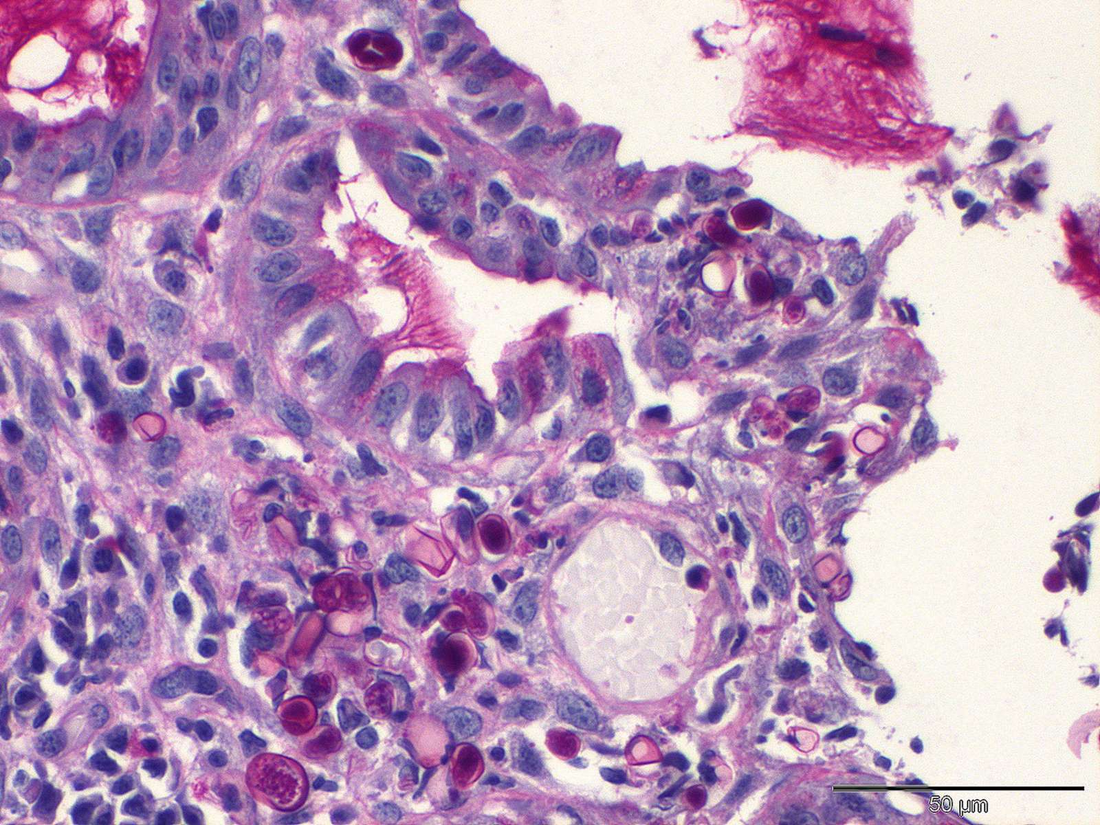 Prototheca infection in a dog | Case Study | Cytopath