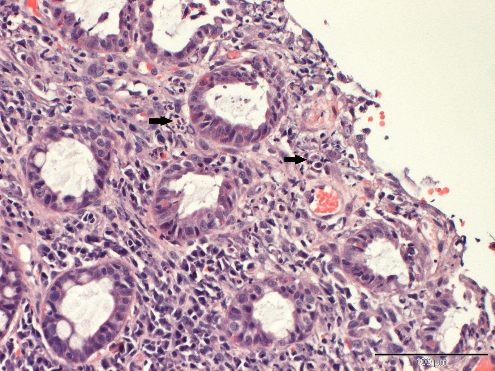 Prototheca infection in a dog | Case Study | Cytopath