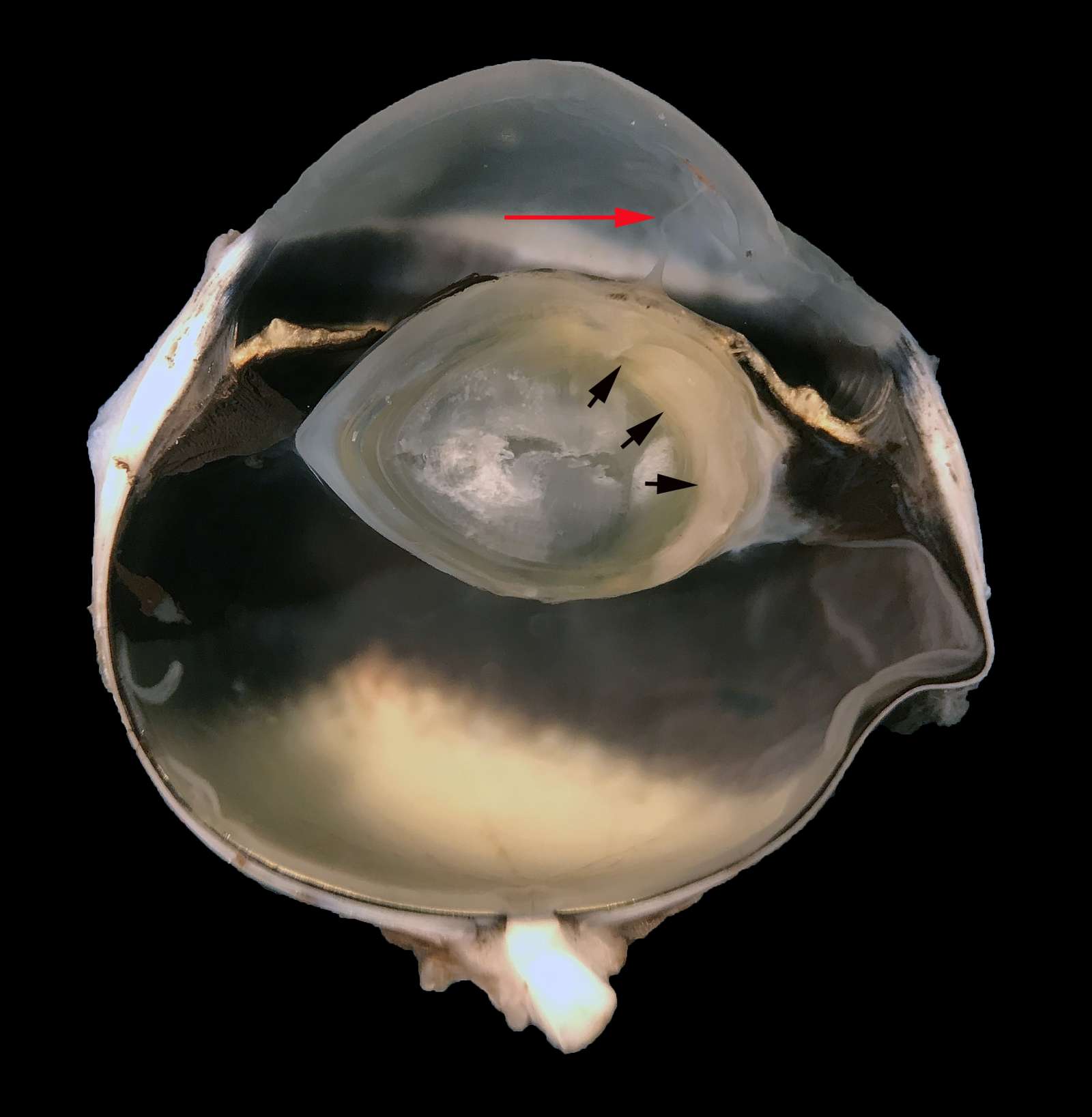 Septic lens implantation syndrome in a cat | Case Study | Cytopath