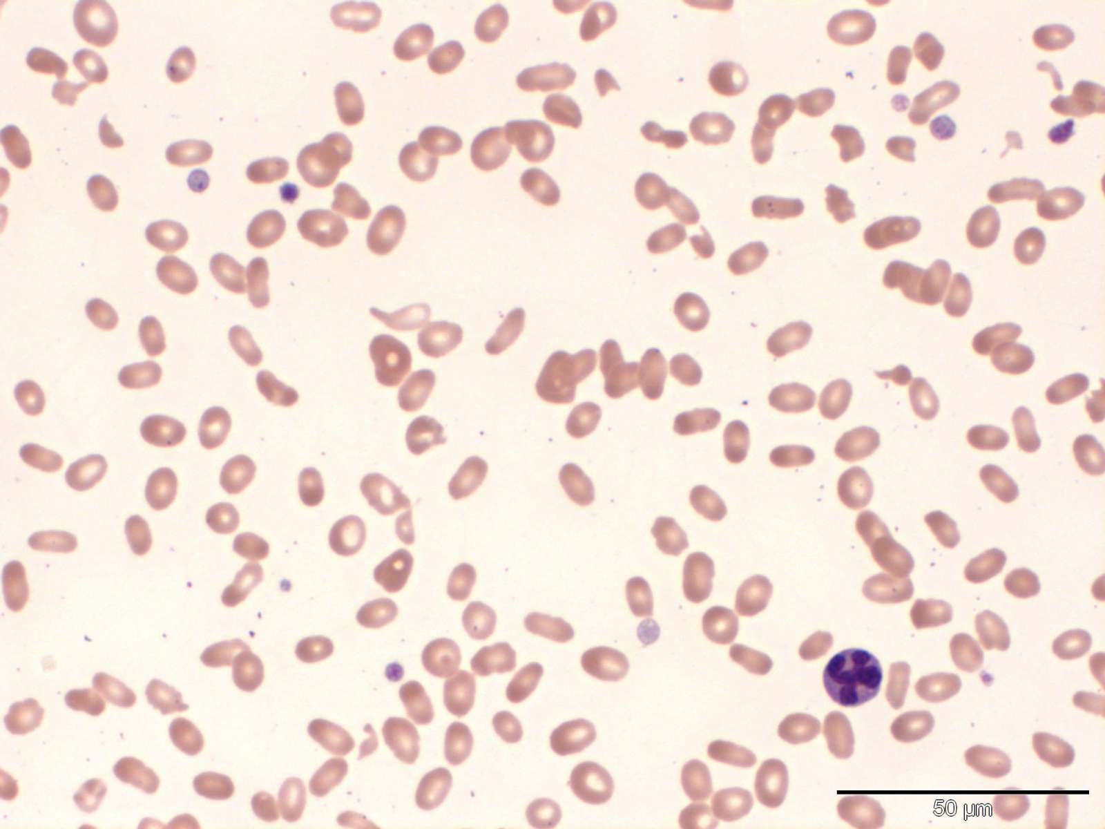 Myelofibrosis in a dog with non-regenerative anaem | Case Study | Cytopath