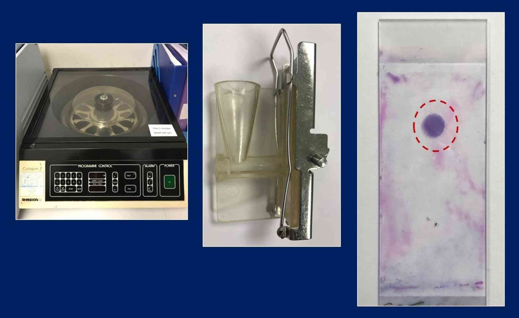 Cytology sample advice | Cytopath