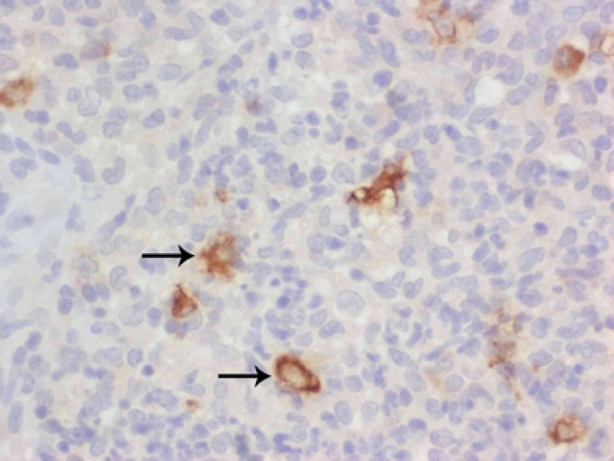 FIP in a cat - an uncommon presentation | Case Study | Cytopath