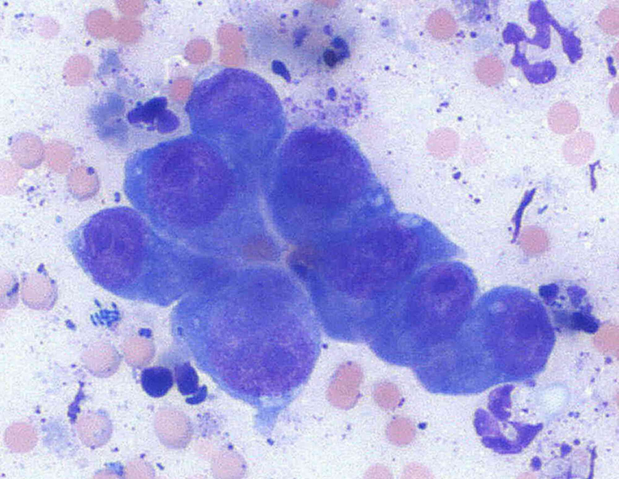‘Lung-digit’ syndrome in a cat | Case Study | Cytopath