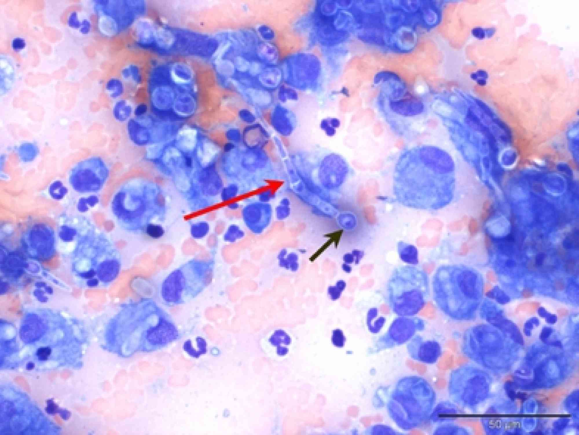 Cutaneous fungal granuloma in a cat | Case Study | Cytopath