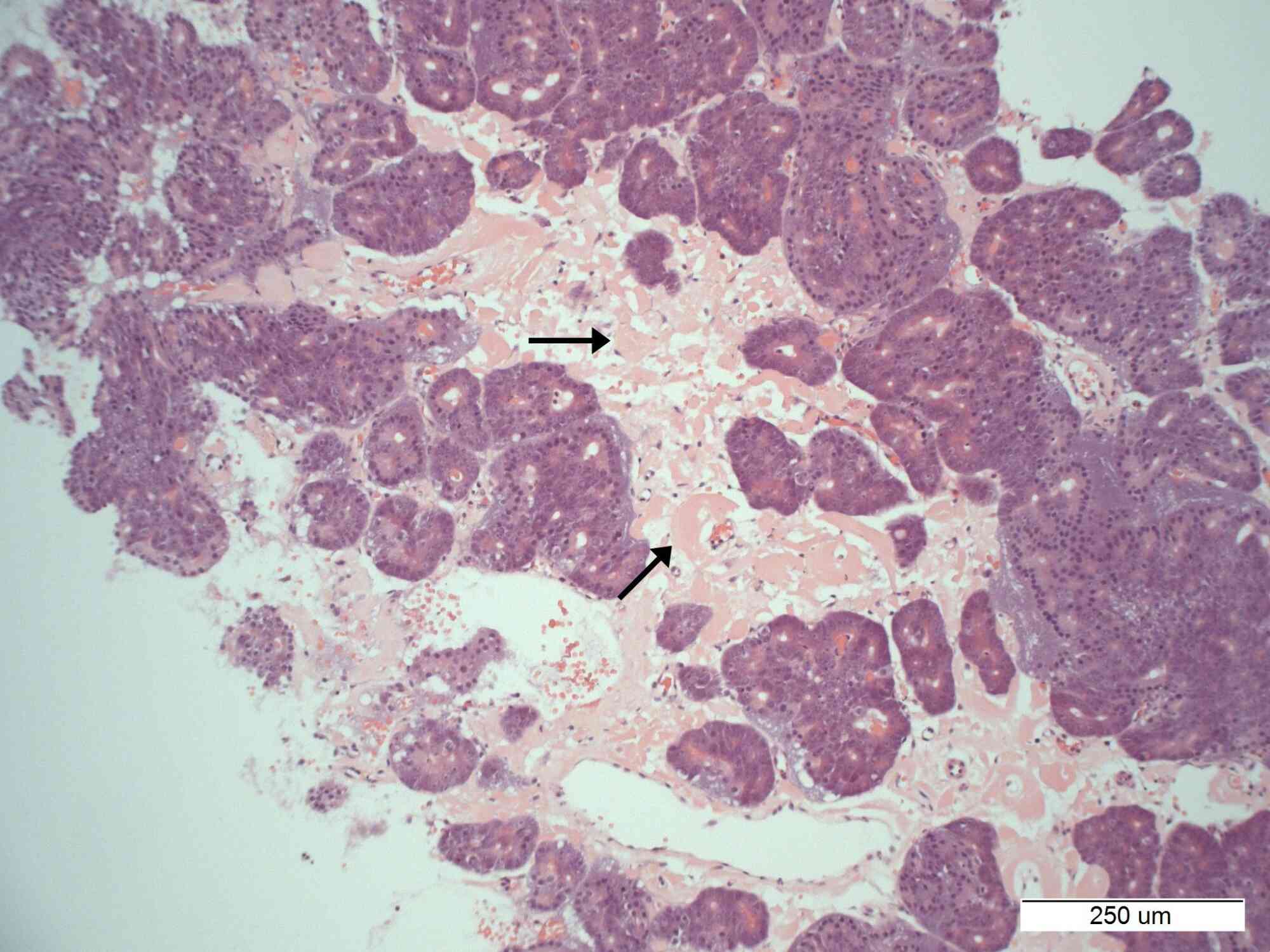 Glomerulonephritis in a dog | Case Study | Cytopath