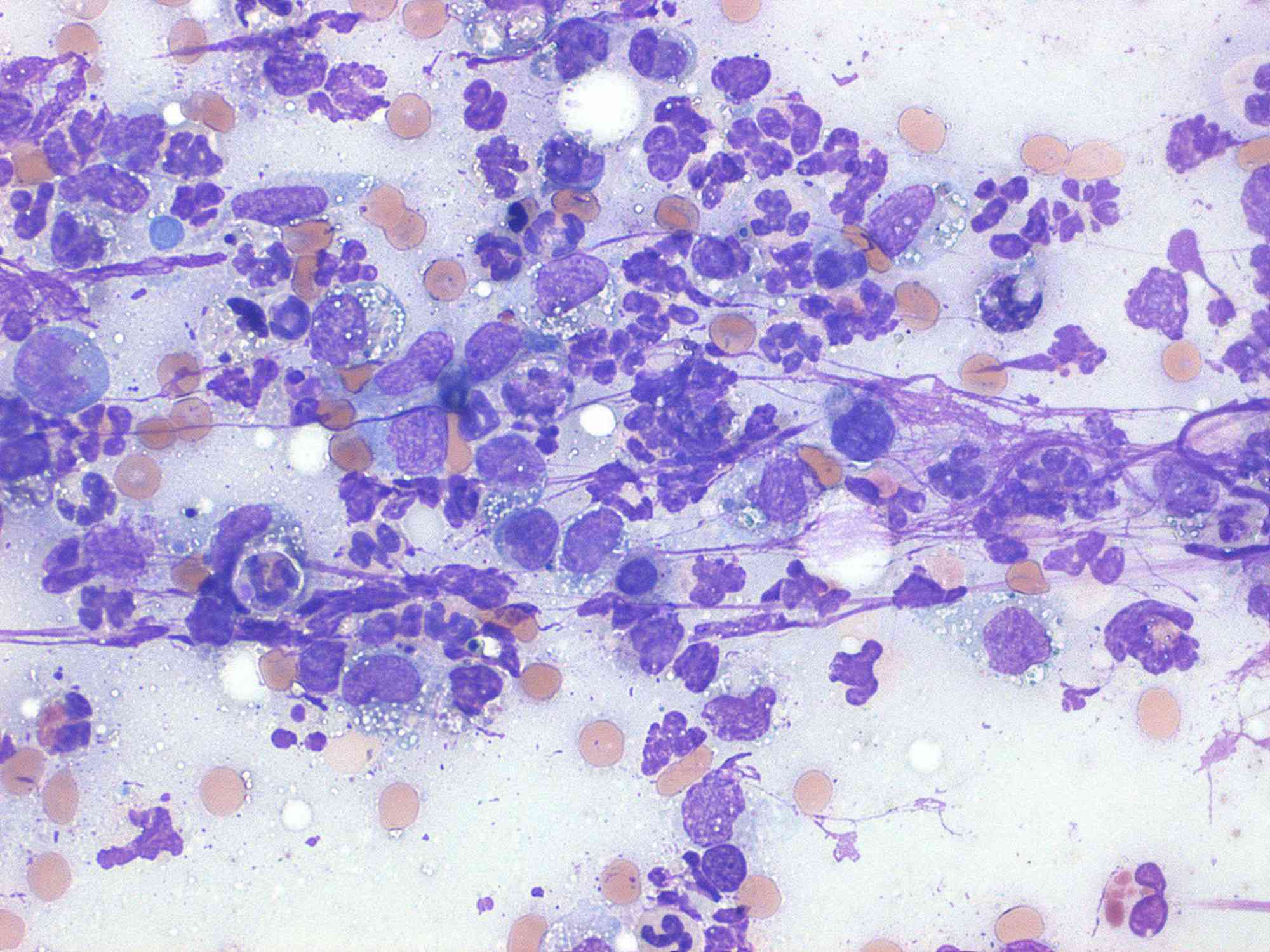 Kerion dermatophytosis in a Cocker spaniel | Case Study | Cytopath