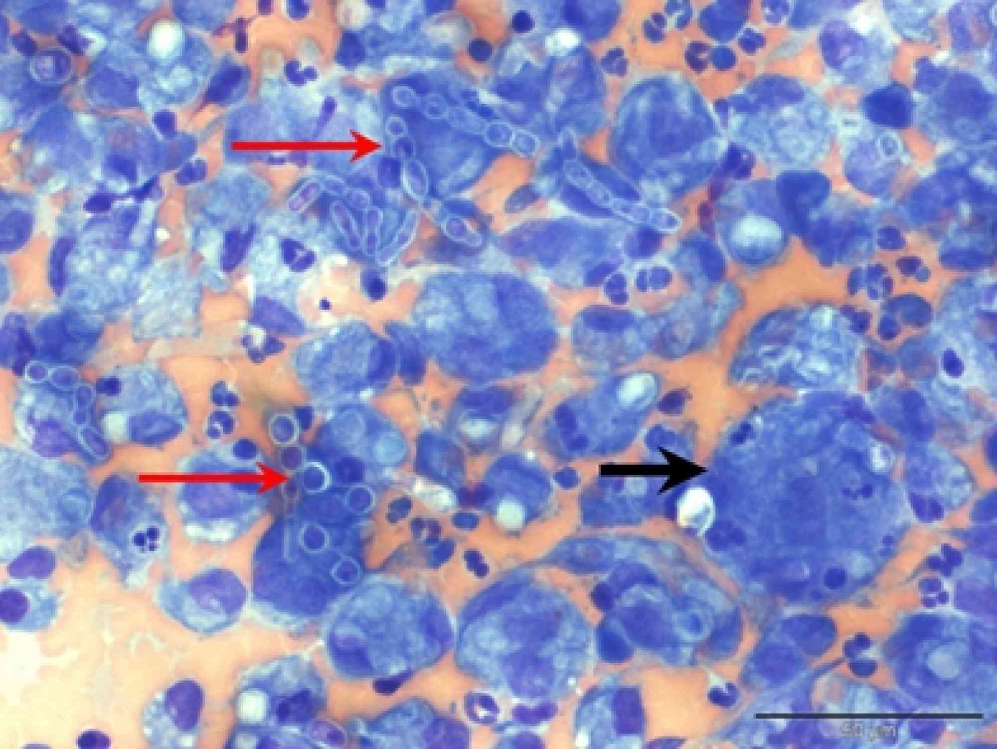 Cutaneous fungal granuloma in a cat | Case Study | Cytopath
