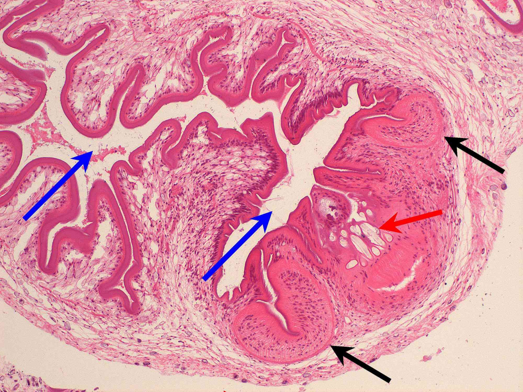 Subcuticular coenurus in a rabbit | Case Study | Cytopath