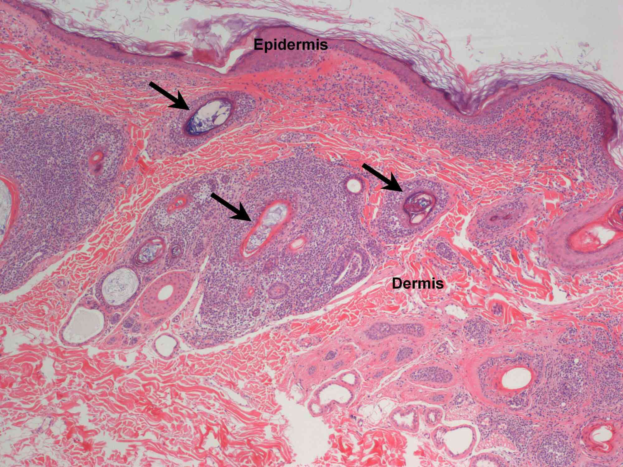 Cutaneous epitheliotropic lymphoma in a Cavalier K | Case Study | Cytopath
