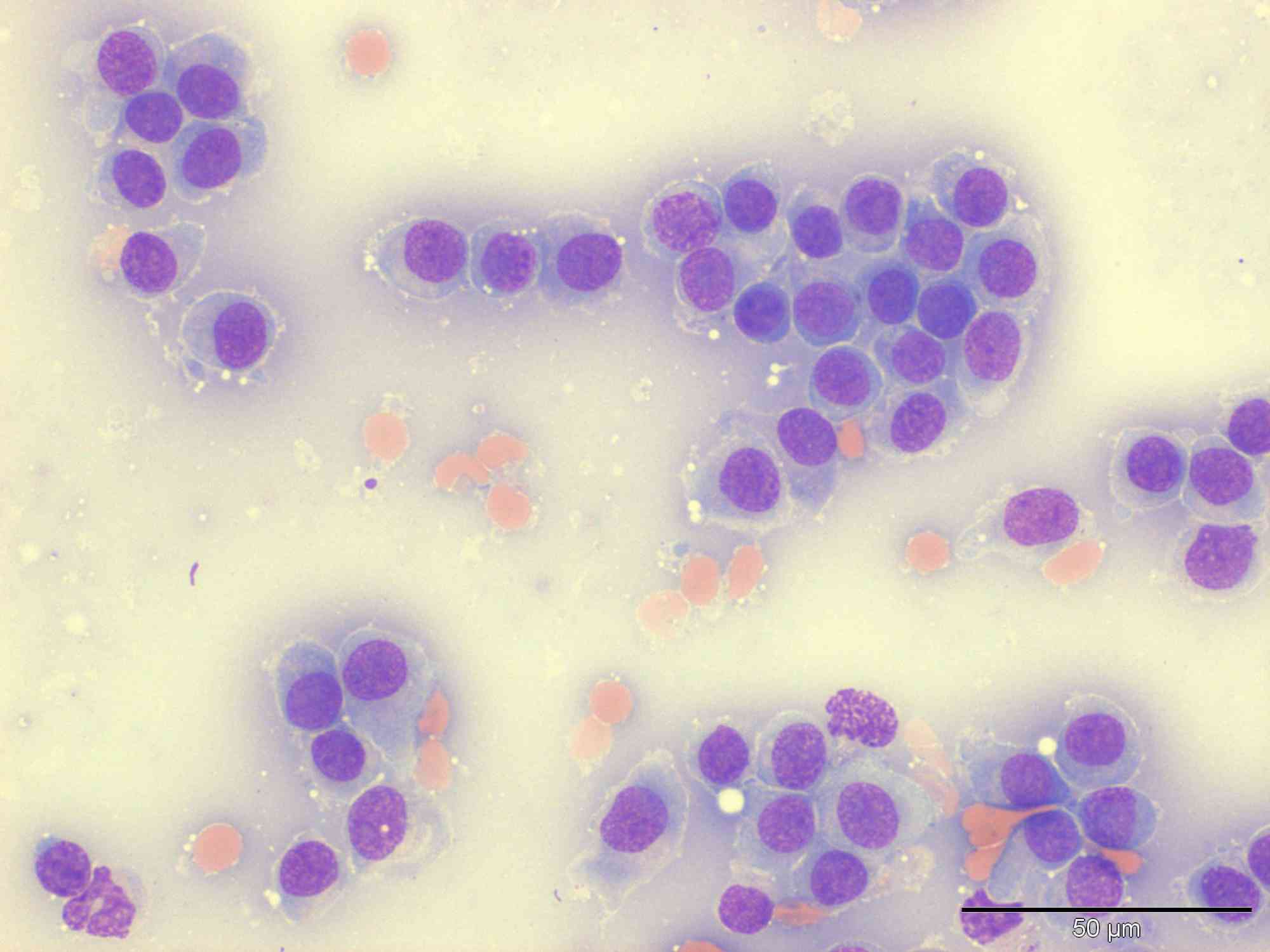 A benign cutaneous histiocytoma in a pug | Case Study | Cytopath