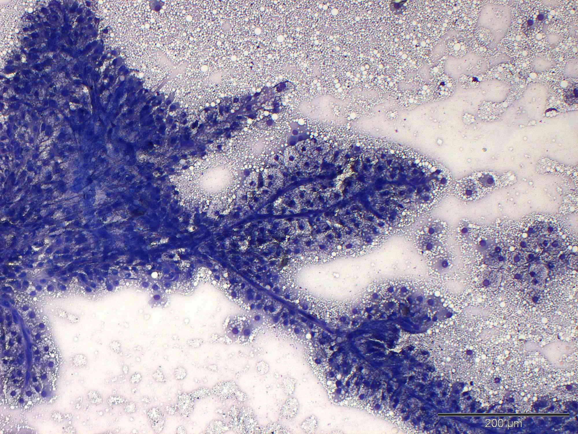 Interstitial (Leydig) cell tumour in a cat | Case Study | Cytopath