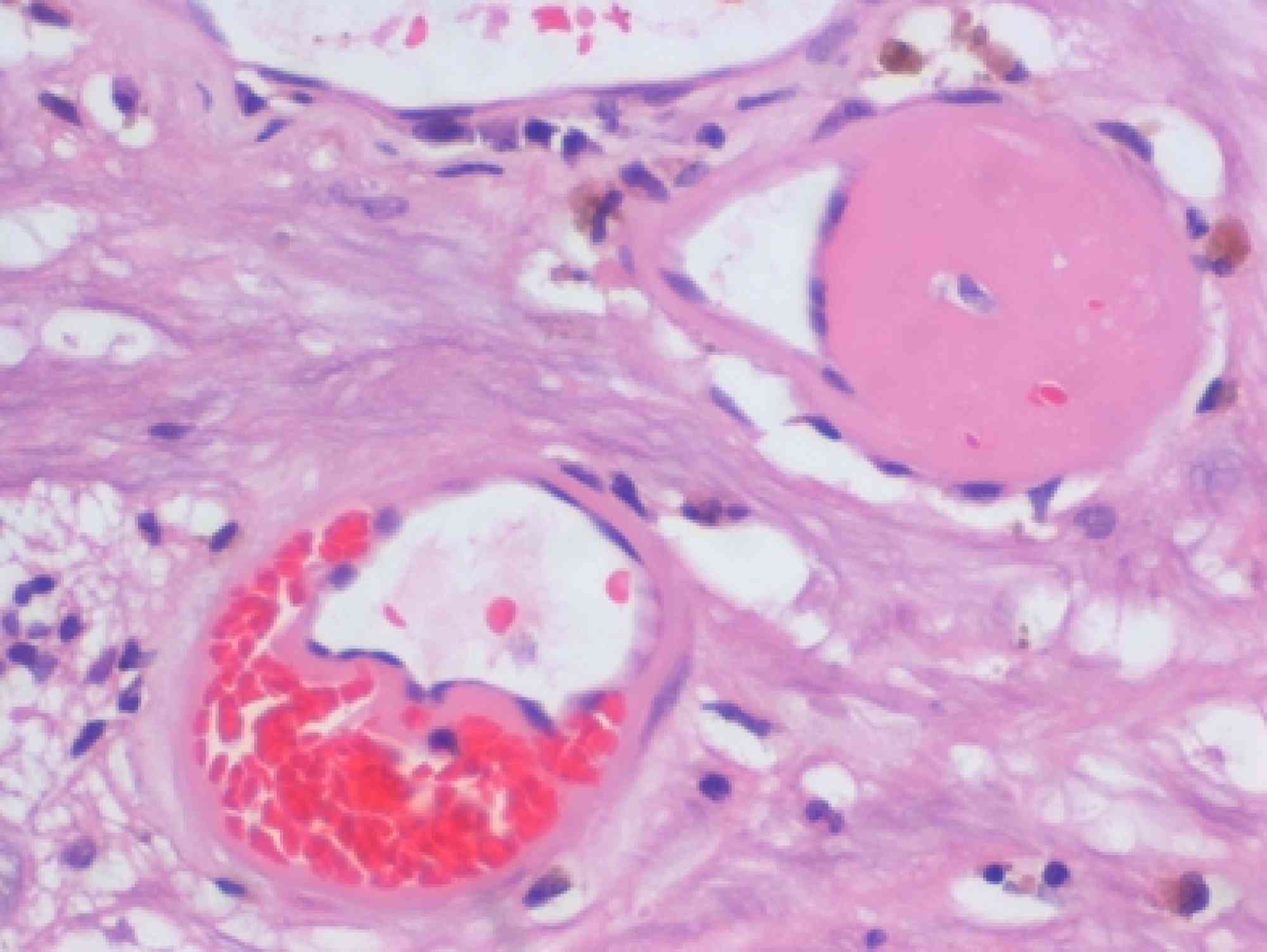 Hypertensive retinopathy in a dog | Case Study | Cytopath