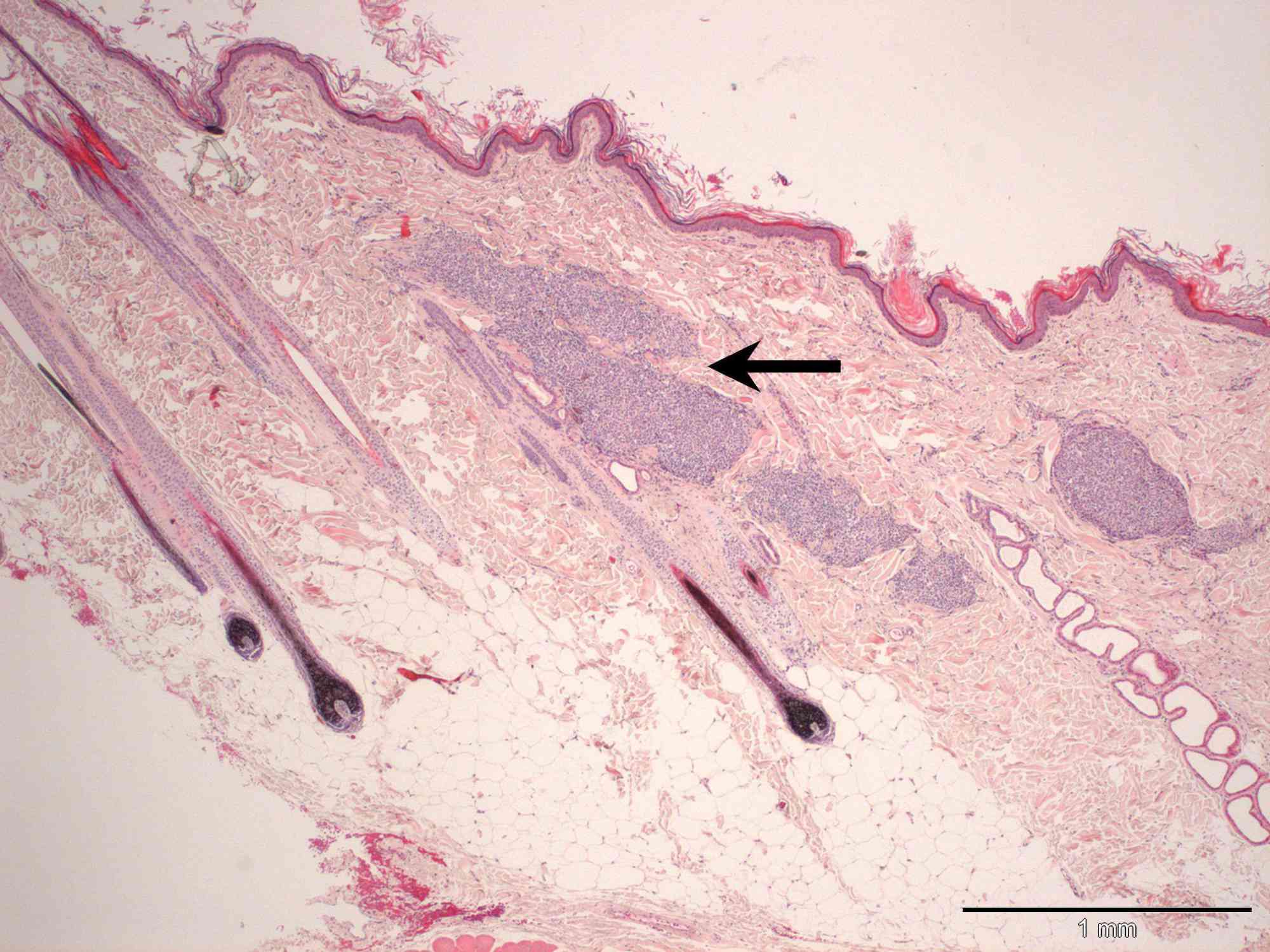 Sebaceous adenitis in a dog | Case Study | Cytopath