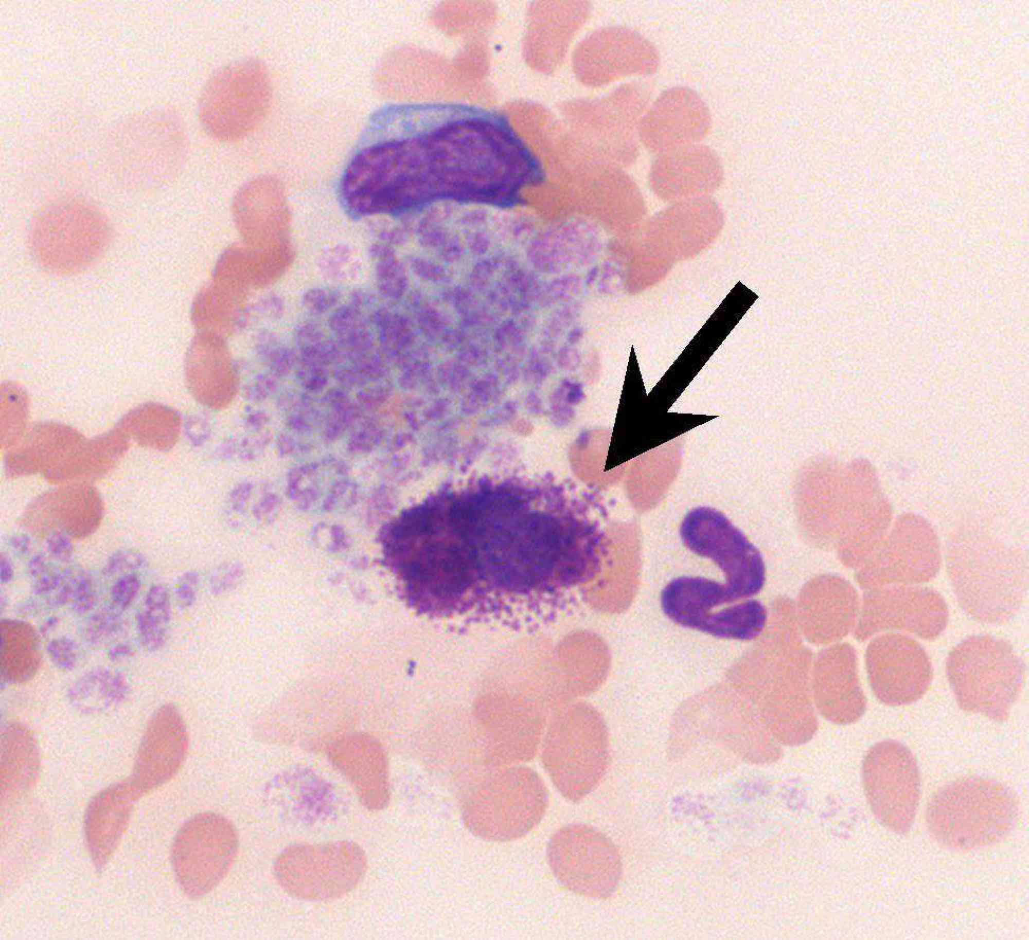 Splenic mast cell tumour in a cat | Case Study | Cytopath
