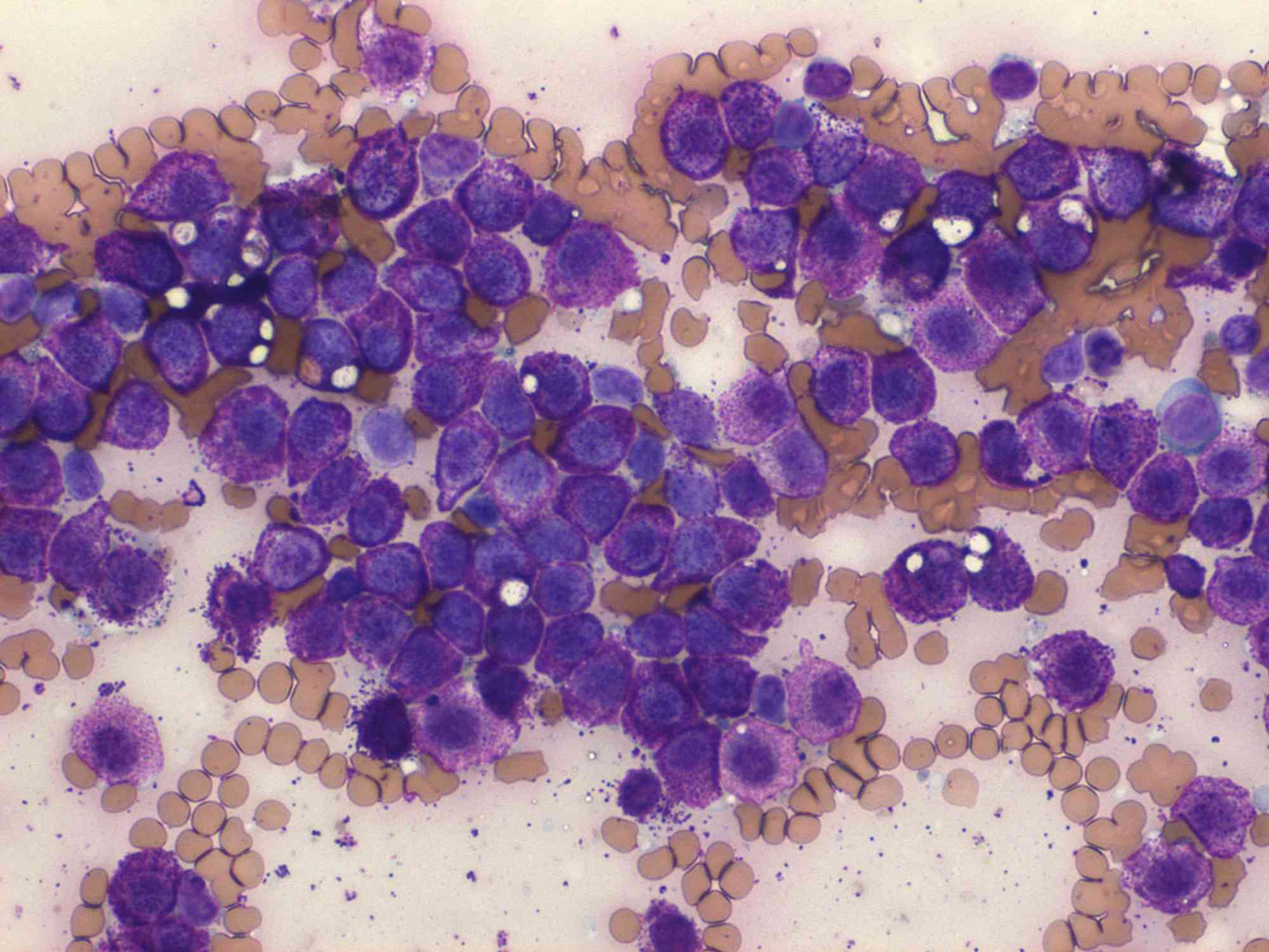 Splenic mast cell tumour in a cat | Case Study | Cytopath