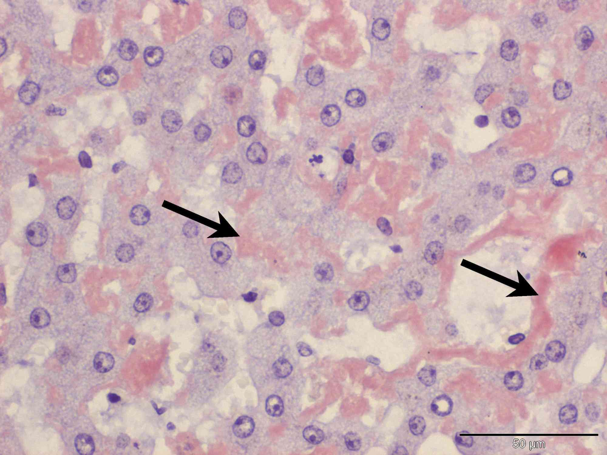 Hepatic amyloidosis in a cat | Case Study | Cytopath