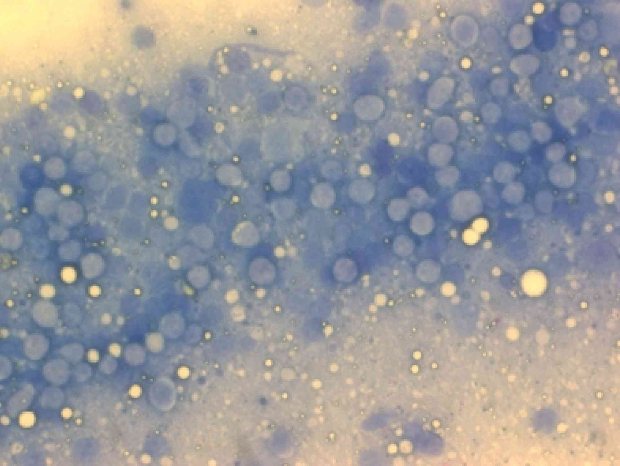 Cytology sample advice | Cytopath