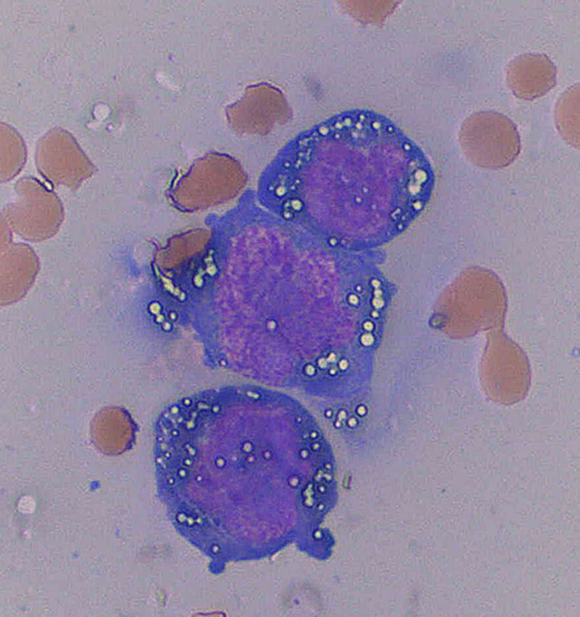 Ocular manifestation of lymphoma in a cat | Case Study | Cytopath