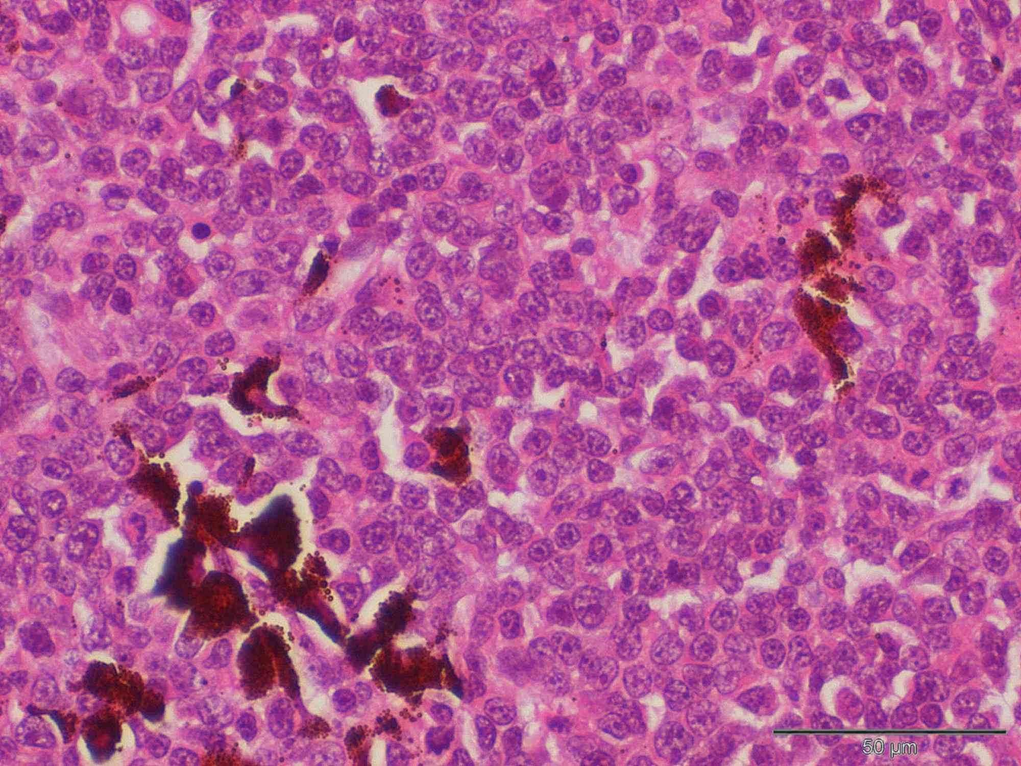Ocular manifestation of lymphoma in a cat | Case Study | Cytopath