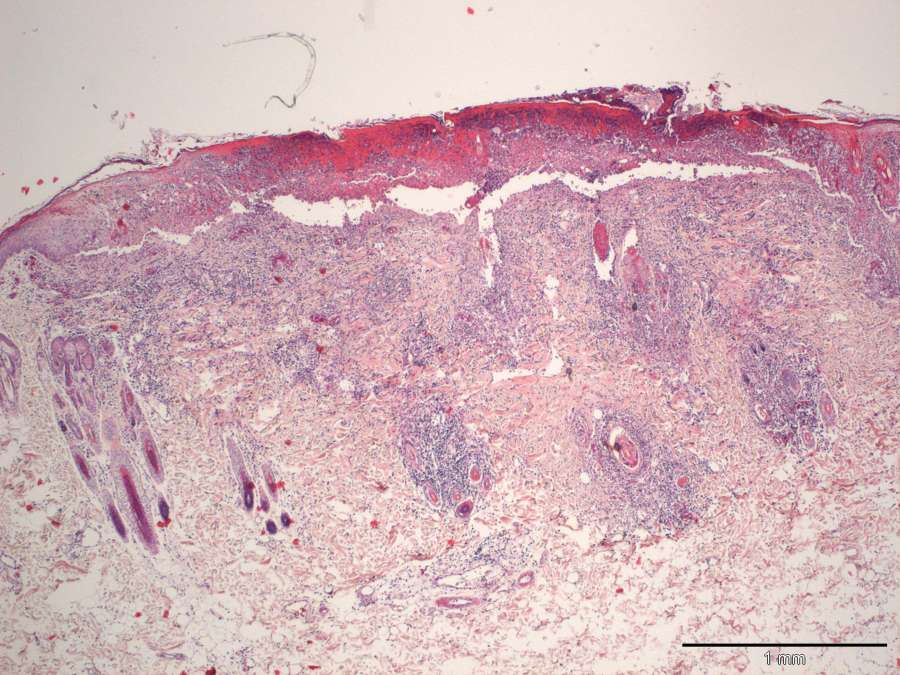 Cutaneous cowpox virus infection in a cat | Case Study | Cytopath