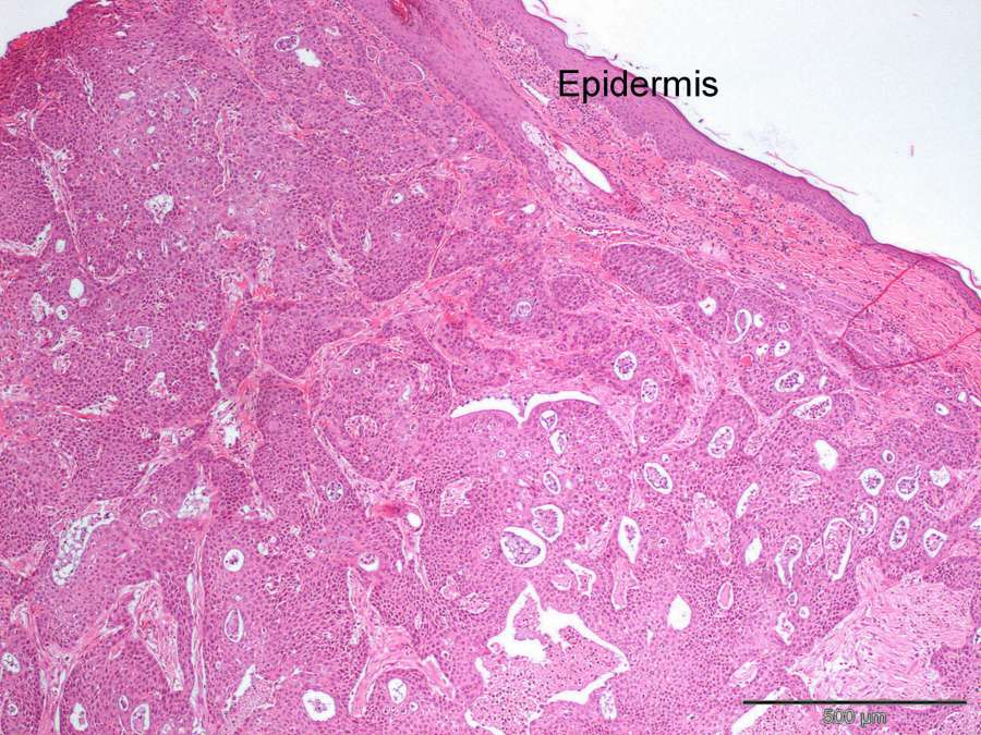 ‘Lung-digit’ syndrome in a cat | Case Study | Cytopath