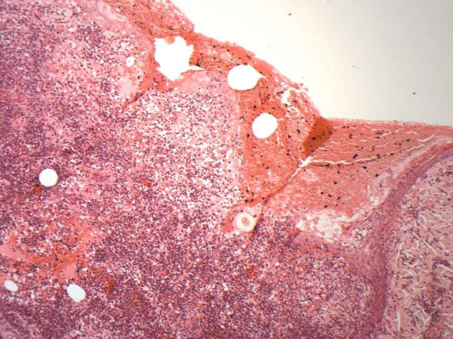 Protozoal dermatitis in a dog | Case Study | Cytopath