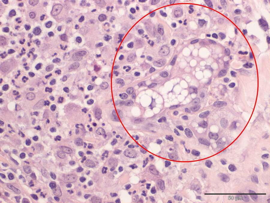 Sebaceous adenitis in a dog | Case Study | Cytopath