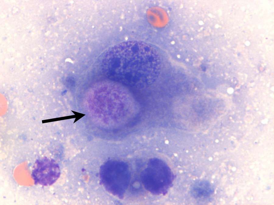 Transitional cell carcinoma (TCC) in a dog | Case Study | Cytopath