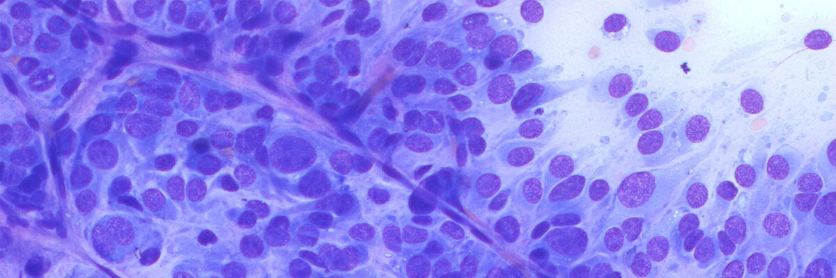 Subcuticular coenurus in a rabbit | Case Study | Cytopath
